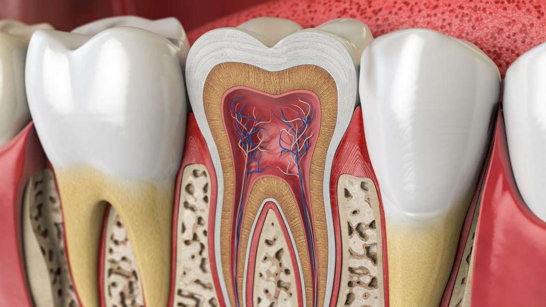 Root Canal Treatment for a Crowned Tooth | Dentist Havertown PA
